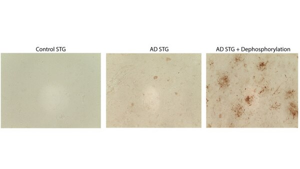 Anti-Tau Antibody, clone 10C5 | MABN2402-25UG